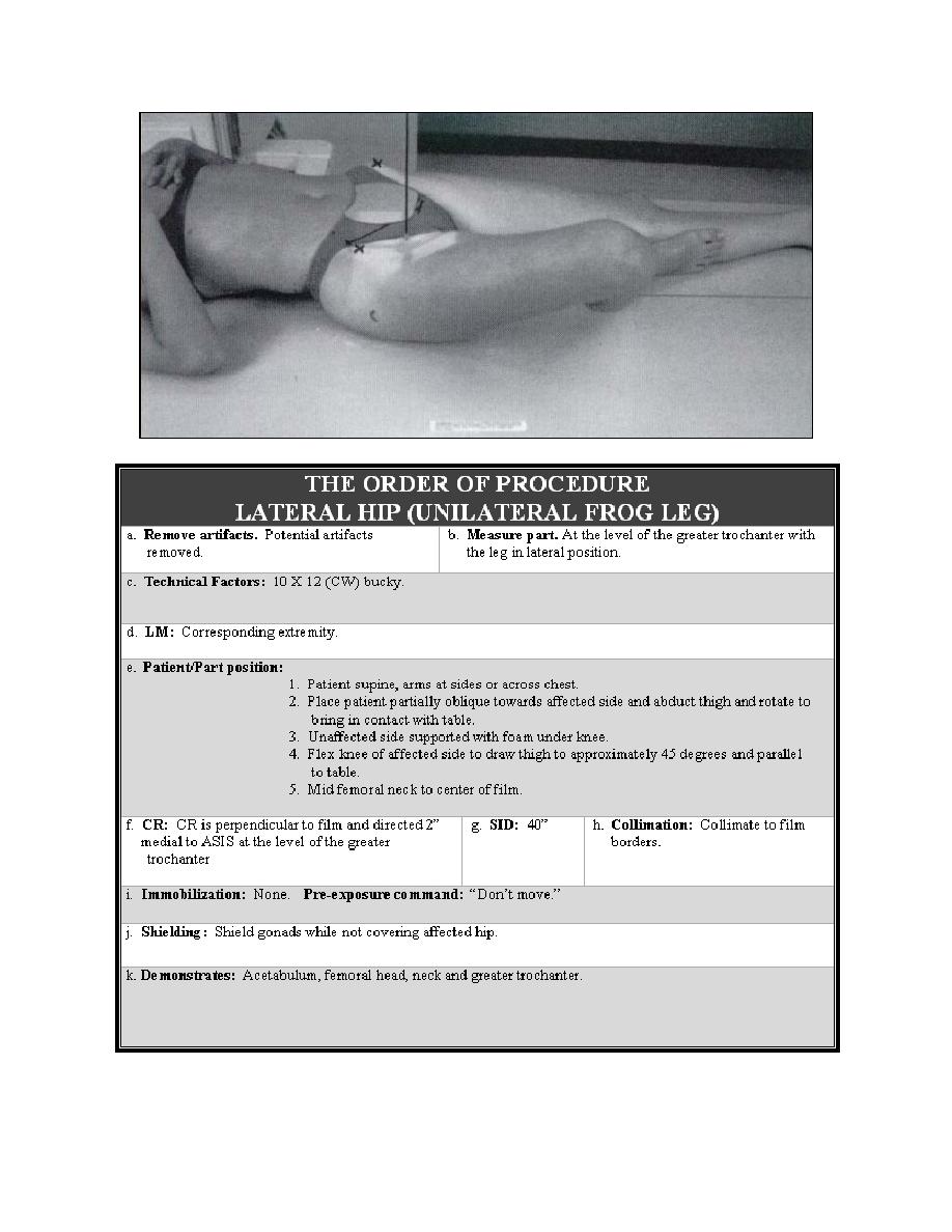 The Order Of The Procedure Lateral Hip Unilateral Frog Leg Standard